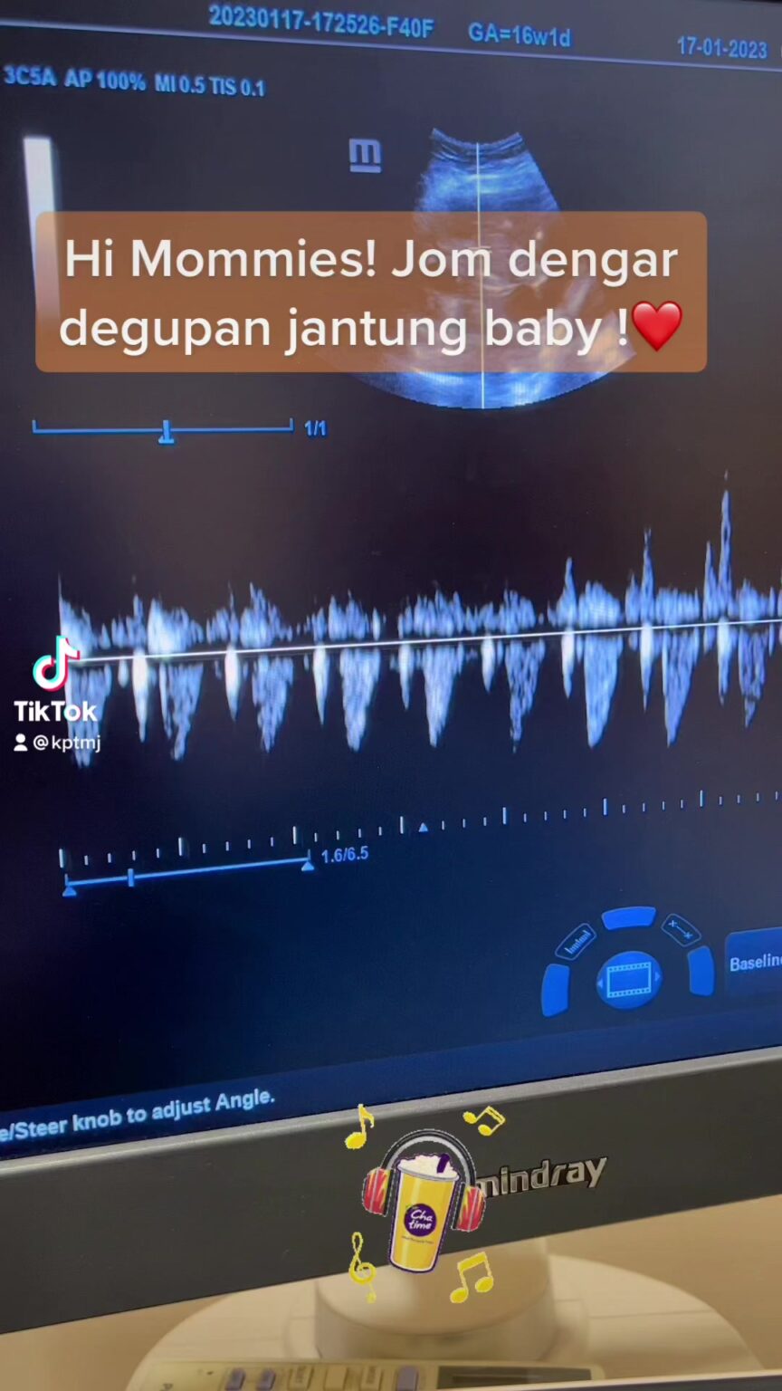 Nak Dapat Gambar Scan Yang Cantik Ada Tipsnya.doktor – Klinik Dr Rafizah